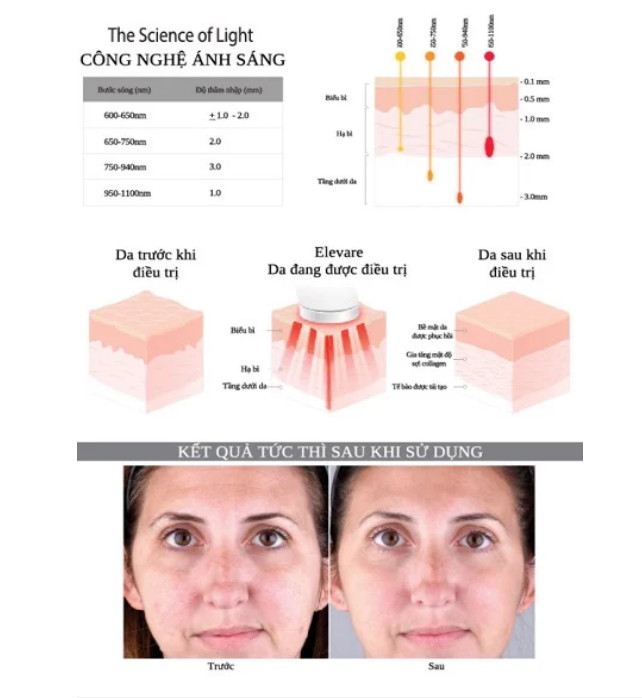 Máy nâng cơ và trẻ hoá da Earth Tech Elevare 750 Plus Gold