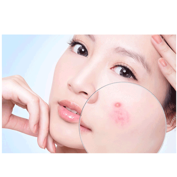 Kem trị mụn Dermalogica Special Clearing Booster tiêu diệt mụn khó nhằn