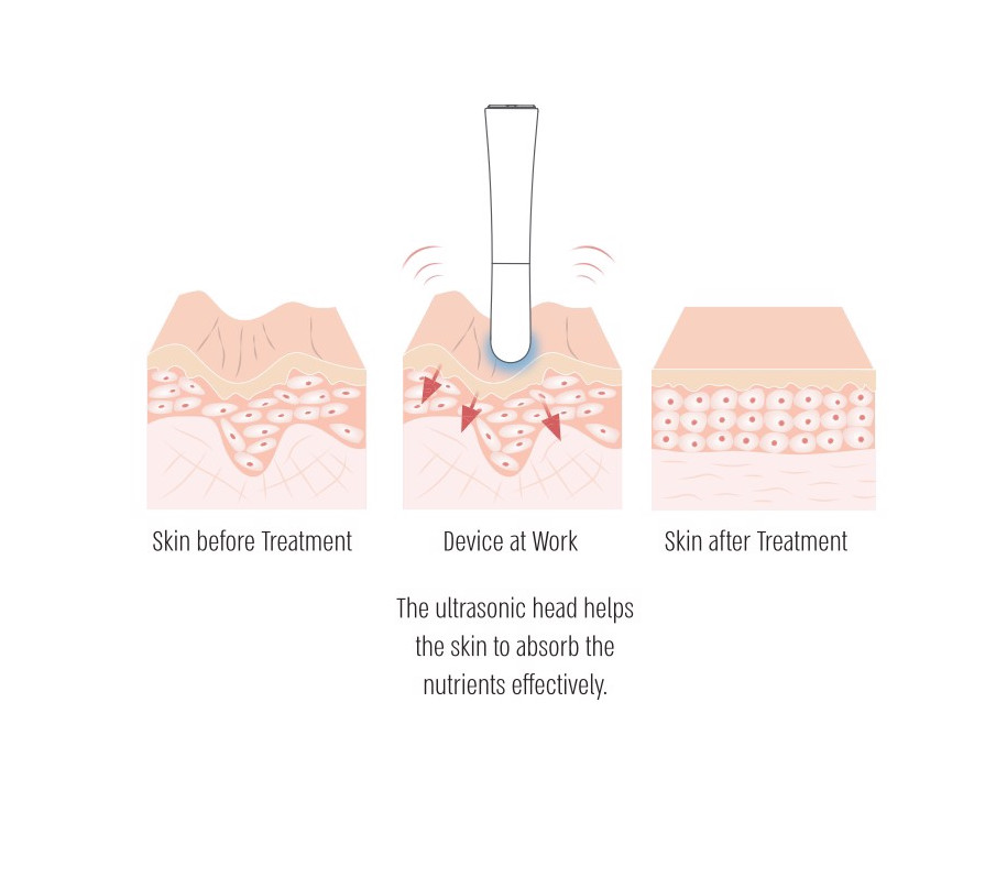 Máy cải thiện vùng da quanh mắt và môi Earth Tech Aecor Eye Machine
