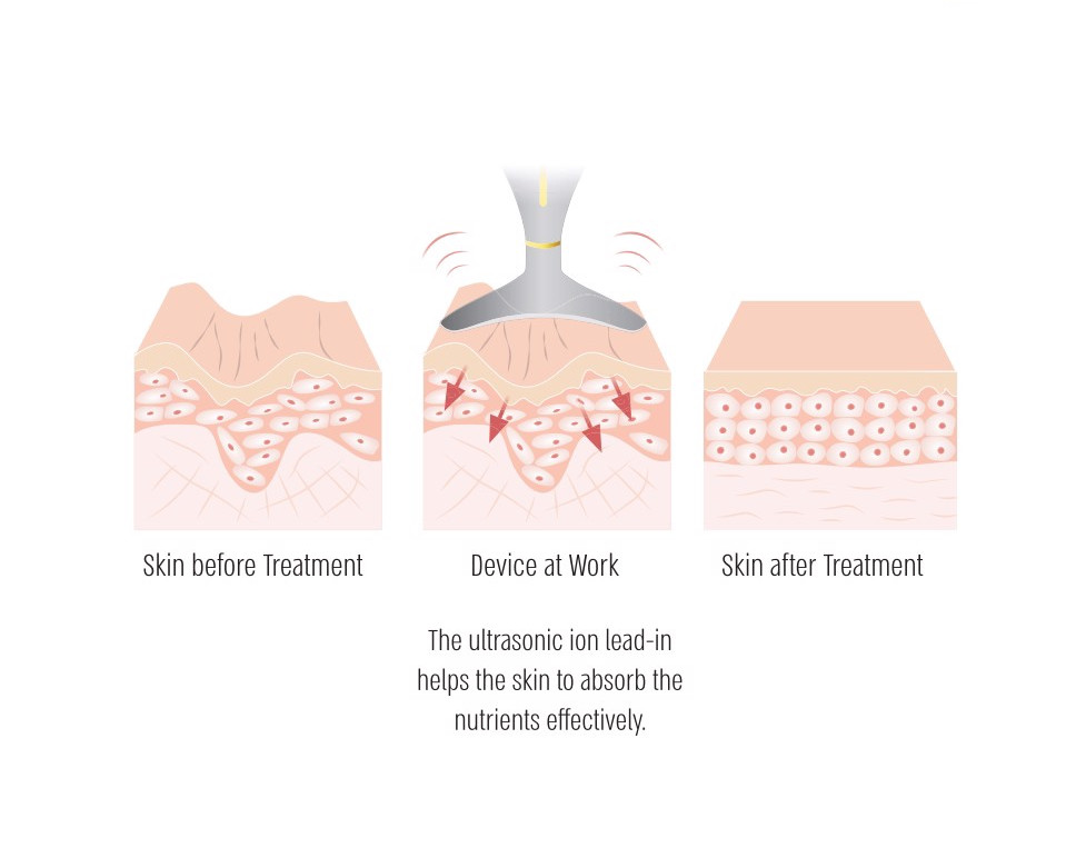 Máy làm đẹp da vùng cổ Earth Tech Aecor Neck Device bạc